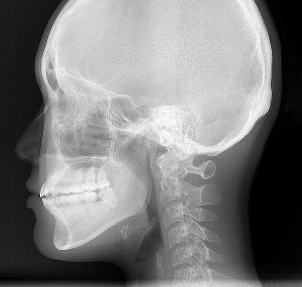 Help Your Bones Hurt Your Jaw Arthritis Advisor help-your-bones-hurt-your-jaw-arthritis-advisor