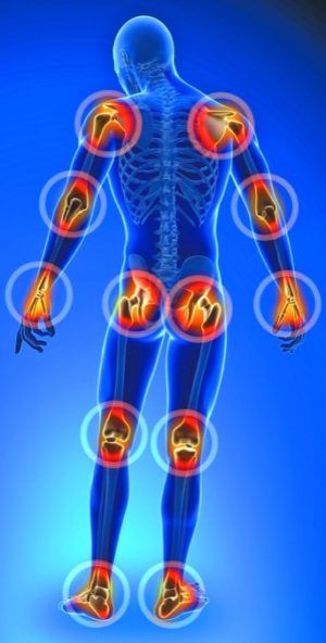What Is Inflammation? - Arthritis Advisor