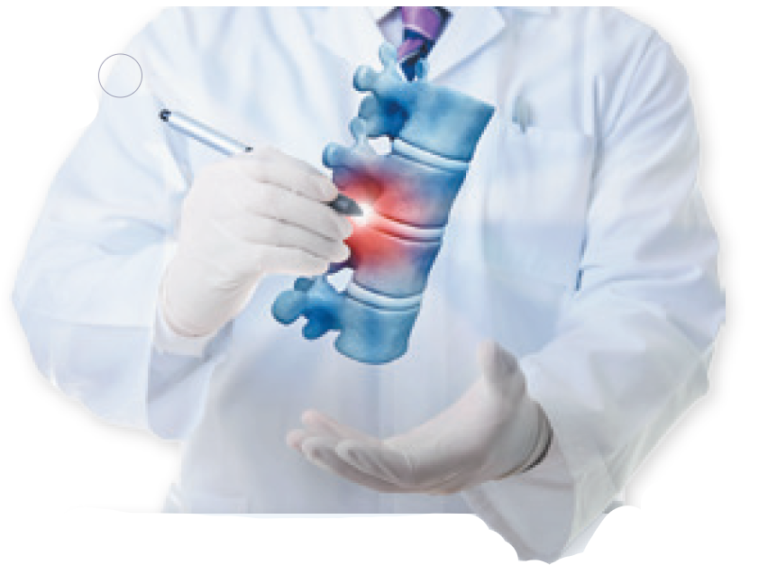 RFA for Back Pain - Arthritis Advisor