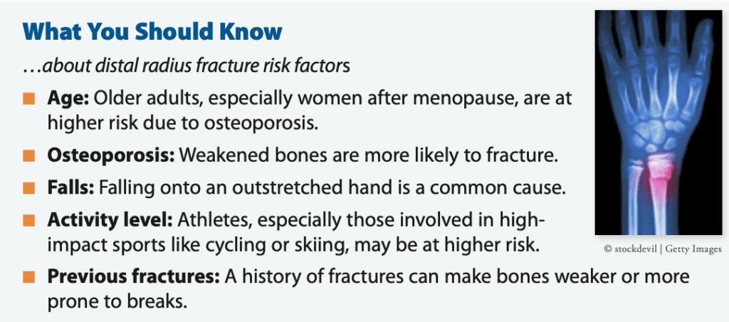 What to Expect if You Have A Distal Radius Fracture - Arthritis Advisor